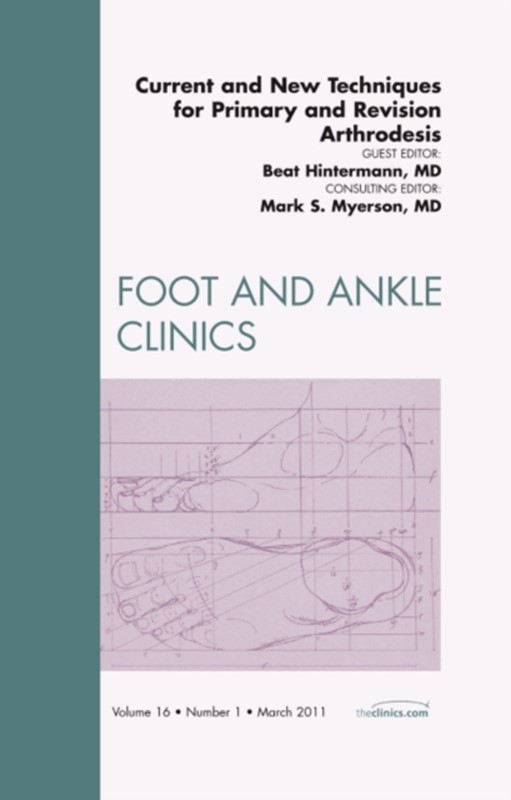 Current and New Techniques for Primary and Revision Arthrodesis, An ...