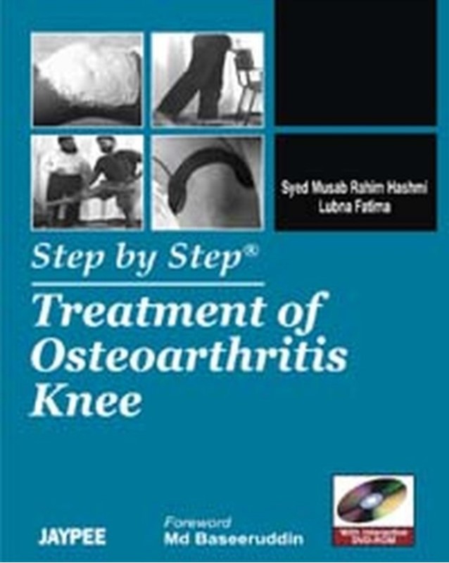 Step by Step: Treatment of Osteoarthritis Knee af Syed Musab Rahim ...
